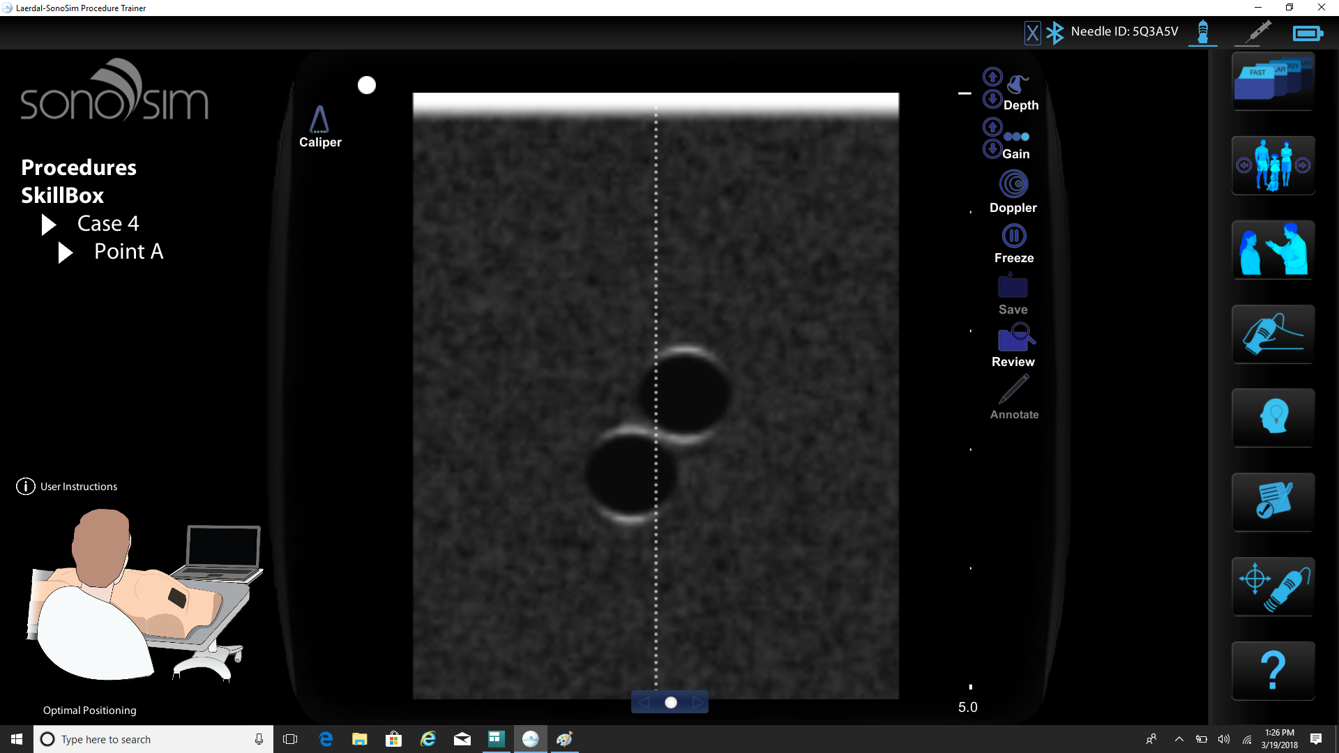Ultrasound Simulation Training | Laerdal-SonoSim Procedure Trainer